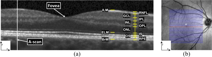 Retinal layer segmentation of macular OCT images - IACL